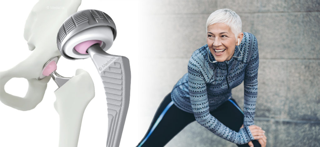 Anterior Hip Replacement - John J. Mercuri, MD